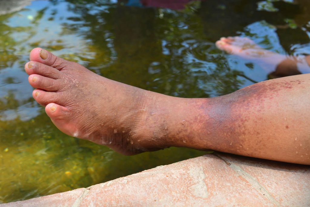 Symptoms - Dr David Smith